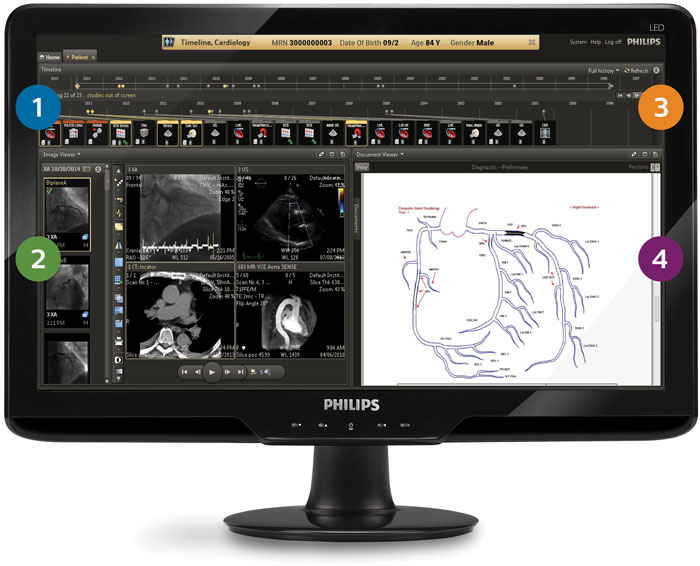 Philips - IntelliSpace Cardiovascular Sistema de gestión de información e imagen